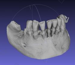 trophy dicom 3D Models | Page 1 | STLFinder