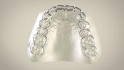 anterior deprogrammer 3d models 【 STLFinder