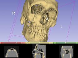 human skull front 3D Models | Page 1 | STLFinder