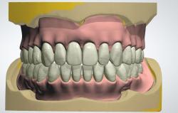 digital print denture machine cost 3D Models | Page 1 | STLFinder