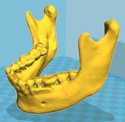 lower mandible 3d models 【 STLFinder