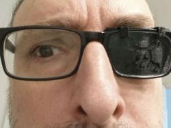 clip on eye patch for glasses 3D Models | Page 1 | STLFinder