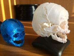 skull of newborn 3D Models | Page 1 | STLFinder
