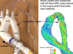 aorta model | Page 1 | STLFinder