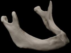 Edentulous Human Mandible 3D Models | Page 1 | STLFinder