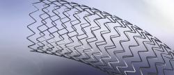 coronary stent request model | Page 1 | STLFinder