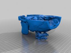 dental ct scan 3D Models | Page 1 | STLFinder
