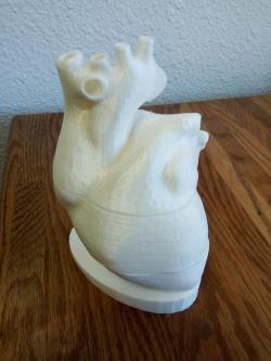 real anatomical heart hollow 3d models 【 STLFinder