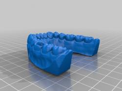 dental 3d models 【 STLFinder
