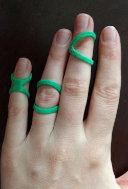 double ring splint for swan neck deformity 3d models 【 STLFinder