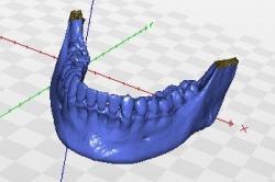 human jaw 3d models 【 STLFinder