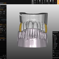 spot implant mua screw size 3D Models | Page 1 | STLFinder