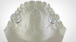 w arch orthodontics 3D Models | Page 1 | STLFinder