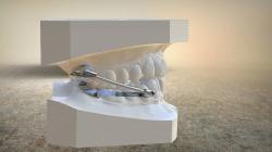 hanks telescoping herbst 3D Models | Page 1 | STLFinder