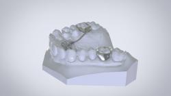 nance appliance 3d models 【 STLFinder