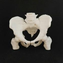 human hip bone 3D Models | Page 1 | STLFinder