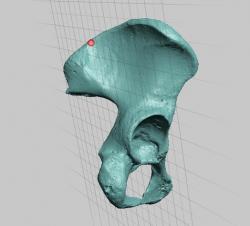 pelvis scan 3D Models | Page 1 | STLFinder