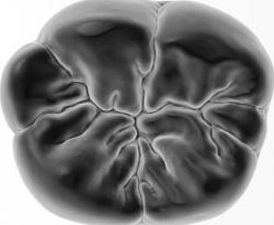 molar 3d view for scl2 | Page 1 | STLFinder