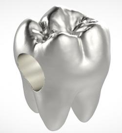 tooth charm for pandora bracelet 3d models 【 STLFinder