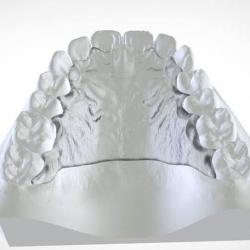 anterior deprogrammer 3D Models | Page 1 | STLFinder
