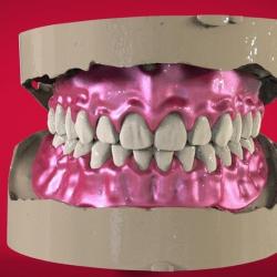 3d printed injection mold 【 STLFinder