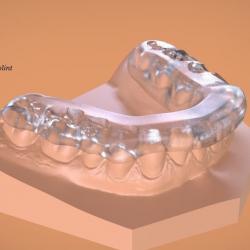 tanner splint 3D Models | Page 1 | STLFinder