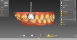 inlab model download | Page 1 | STLFinder