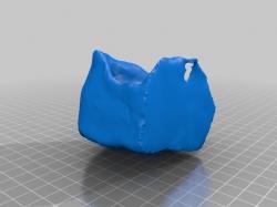 model of oropharynx with peritonsillar abscess | Page 1 | STLFinder