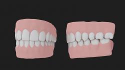 blender teeth model 【 STLFinder