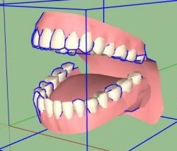 3d open mouth 【 STLFinder
