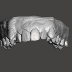 teeth model scan template download | Page 1 | STLFinder
