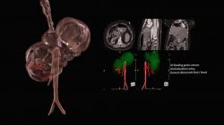 gi bleed black tarry stool dog 3D Models | Page 1 | STLFinder