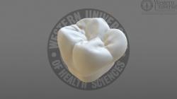 maxillary 1st molar 3d models 【 STLFinder