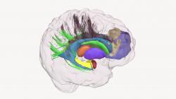 realistic brain model subcortical structures 3d models | Page 1 | STLFinder