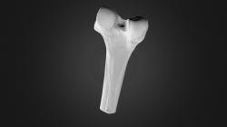 3d bone scan | Page 1 | STLFinder