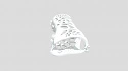 3d print splint 【 STLFinder