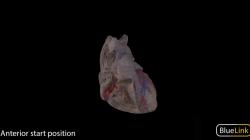 sfxyj 2x enlarged anatomical heart model 4 part removable with ...