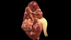 stg renal 3D Models | Page 1 | STLFinder