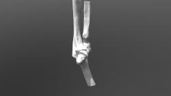 hammertek elbow 3d models 【 STLFinder