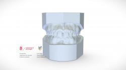 relative enamel thickness primary lower jaw crowns upper jaw crowns 3D ...