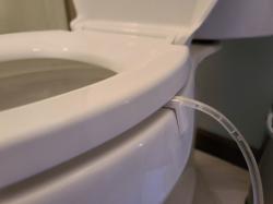 three pore model peritoneal dialysis | Page 1 | STLFinder