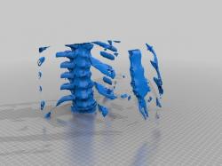 ct scan of ribs 3d models 【 STLFinder