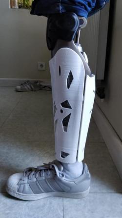 ottobock 3r80 cover 3d design | Page 1 | STLFinder