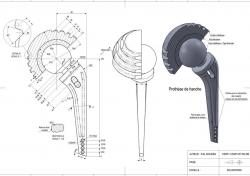 prosthetic hip 3D Models | Page 1 | STLFinder