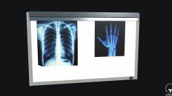 X ray Lightbox 3D Models | Page 1 | STLFinder