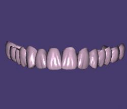 dental arch 3d models 【 STLFinder