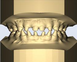 sharp monster teeth 3D Models | Page 1 | STLFinder
