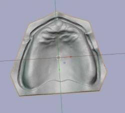 edentulous maxilla 3D Models | Page 1 | STLFinder
