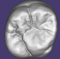 molar molar 3D Models | Page 1 | STLFinder
