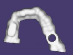 surgical guide 3D Models | Page 1 | STLFinder